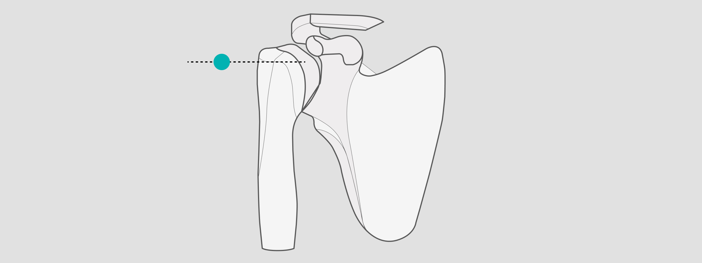 How to do X-ray calibration: from markers to magnification